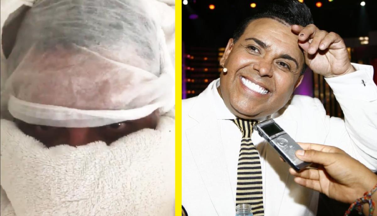 'Chibolín' estrena nuevo rostro en #YoCarlos - Exitosa Noticias