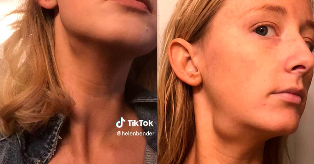Mujer descubre que tiene cáncer en etapa 4 tras realizar rutina de ...