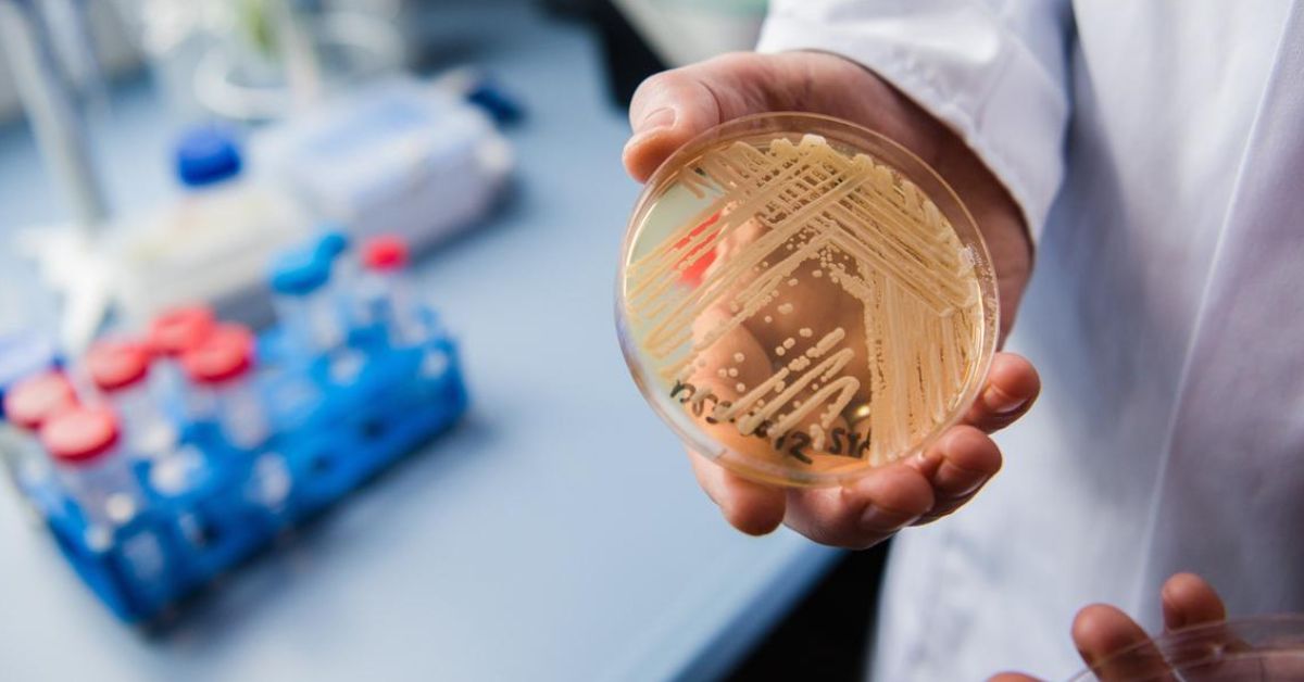 Candida Auris: El hongo que ha puesto en alerta a Estados Unidos, ¿qué ...