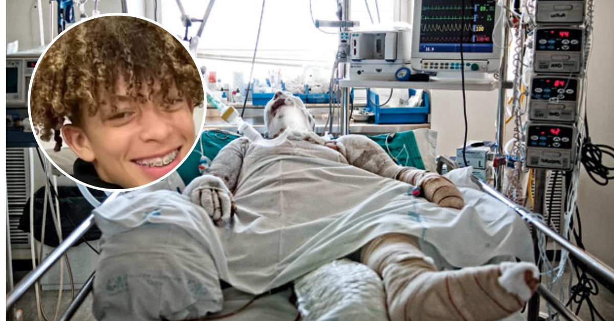 ¡Escalofriante! Adolescente realiza reto de TikTok y termina con el 76% ...