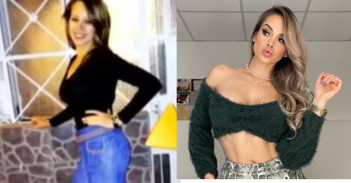 ¿tiene Cirugías El Sorprendente Cambio Físico De Jossmery Toledo A