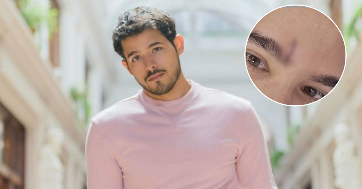 Andrés Vílchez: Actor sufrió accidente en el gimnasio y muestra cómo ...