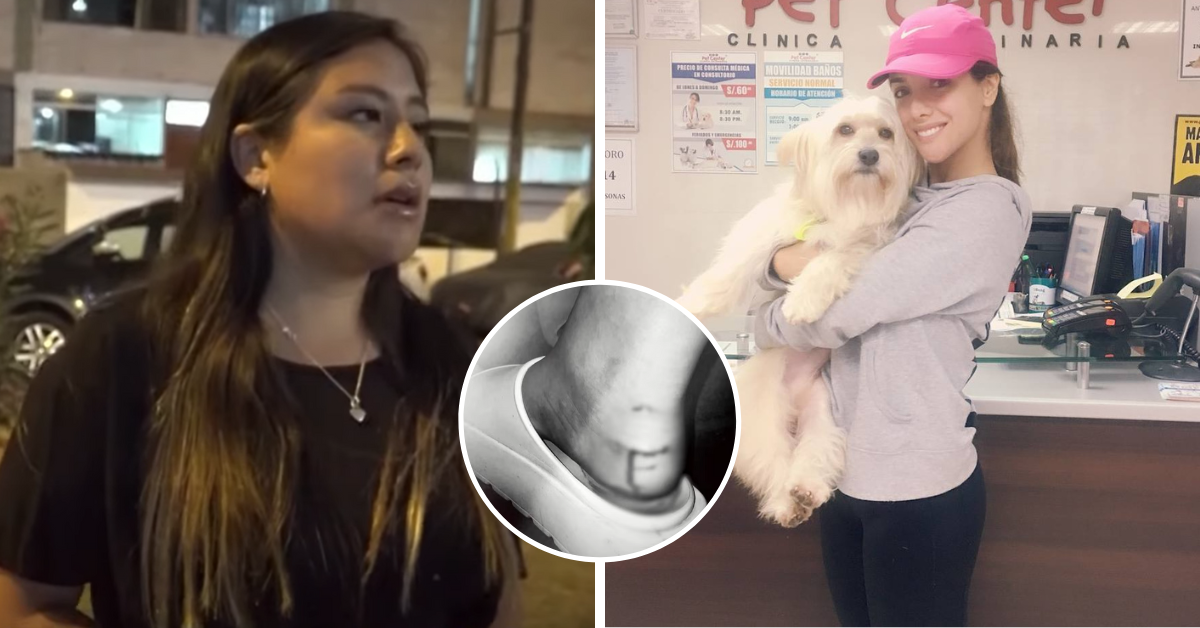 ¡escándalo Mujer Denuncia Que Perrito De Rosángela Espinoza La Mordió