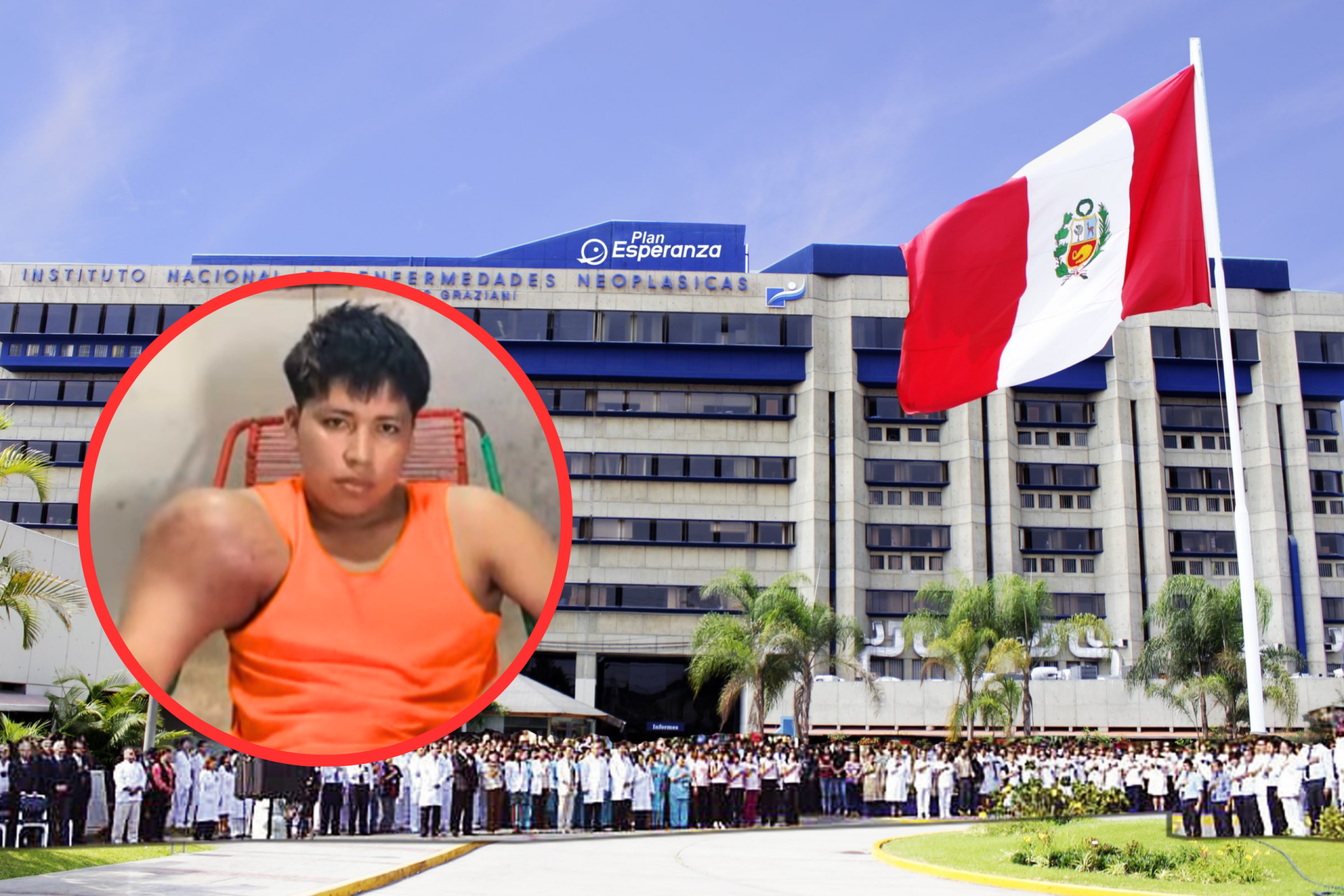 Joven de Pucallpa presenta un gran tumor en el hombro y pide ayuda para ...